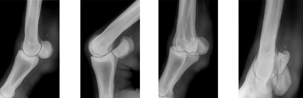 Case Selection - Arti-Cell® Forte